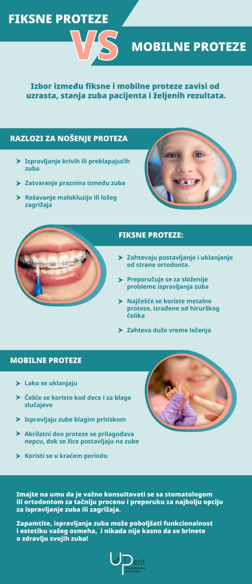 Kada se preporučuje fiksna a kada mobilna proteza