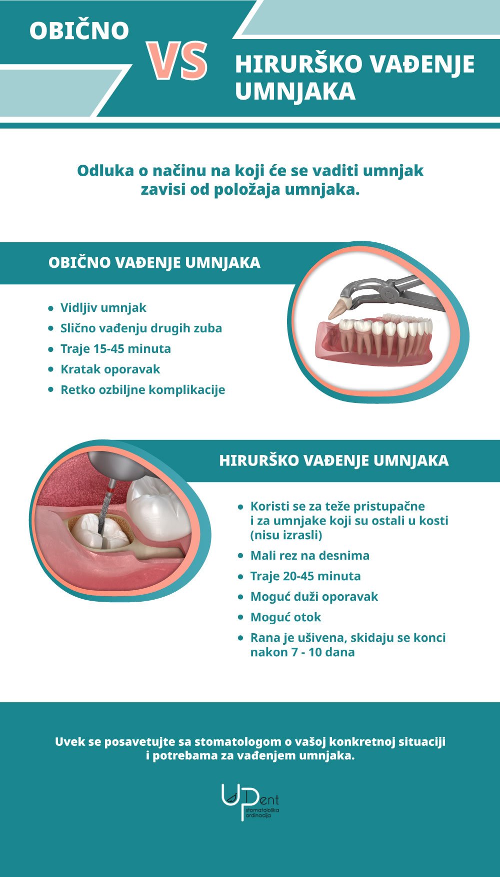 Obično vs. hirurško vađenje umnjaka: Šta očekivati - Stomatološka ...