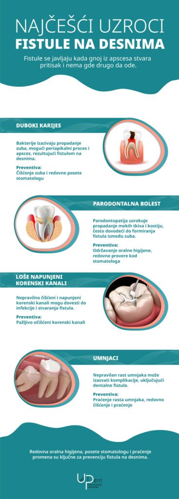 Fistule na desnima: Kako ih prepoznati i lečiti - Stomatološka ...